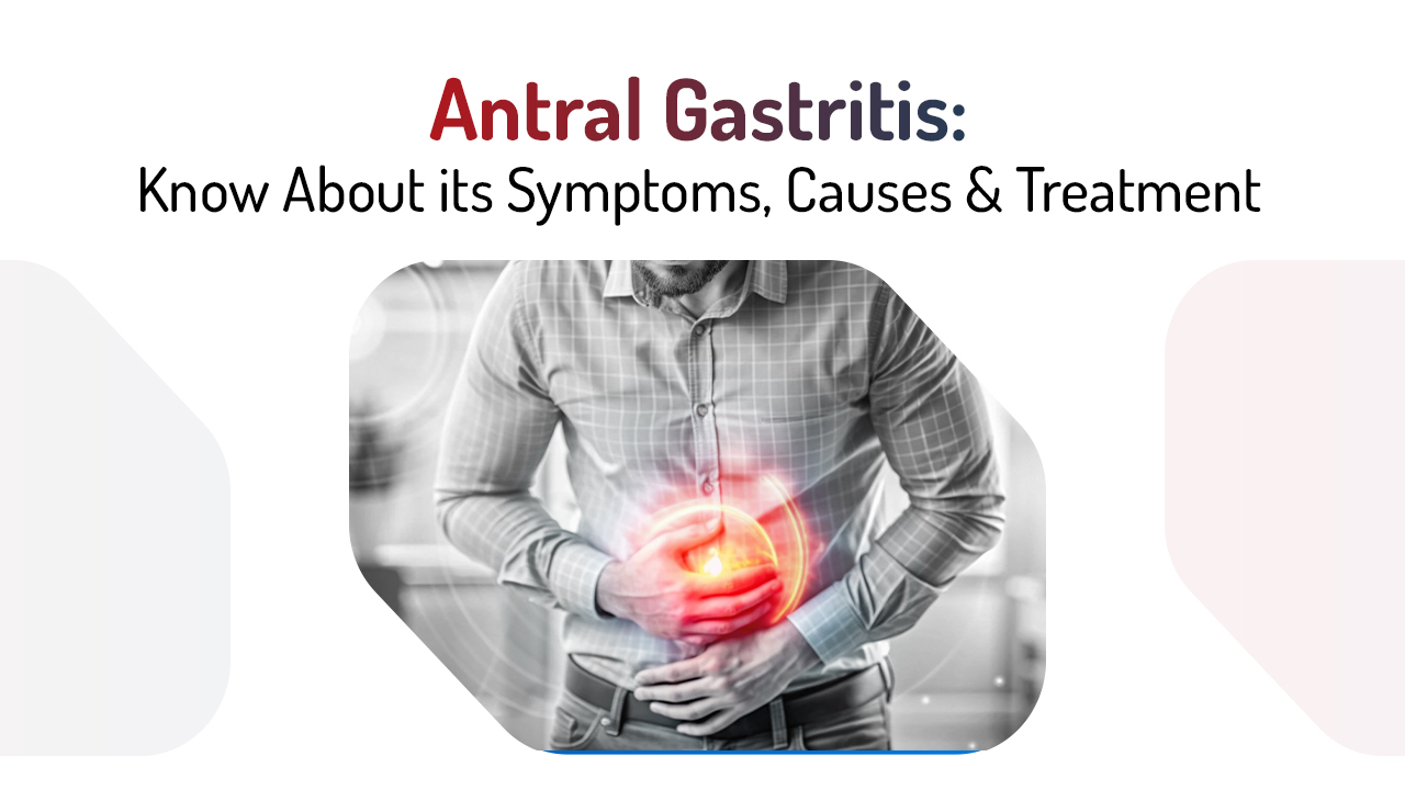 Antral Gastritis: Know About its Symptoms, Causes & Treatment