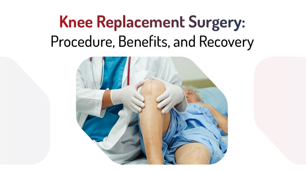 Knee Replacement Surgery: Procedure, Benefits, and Recovery - Sravani ...
